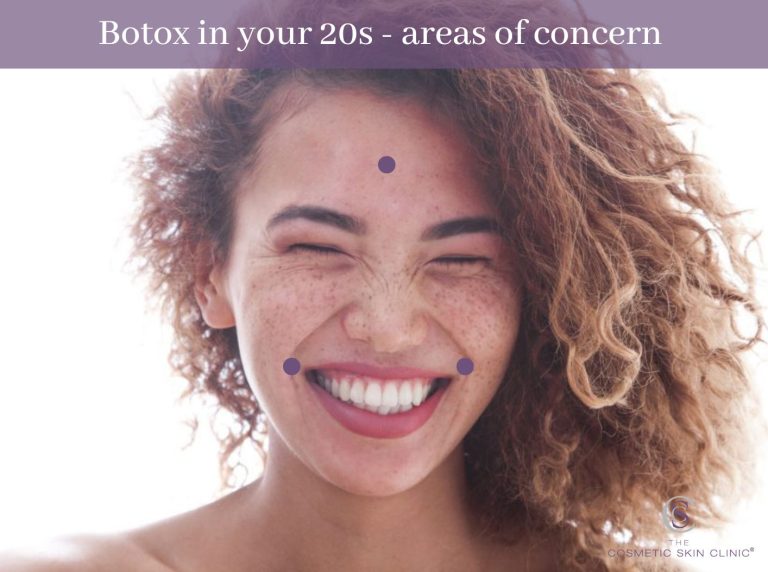 What age to get Botox - Preventative Botox - Botox 20s, 30s, 40s, 50s, 60s | The Cosmetic Skin ...