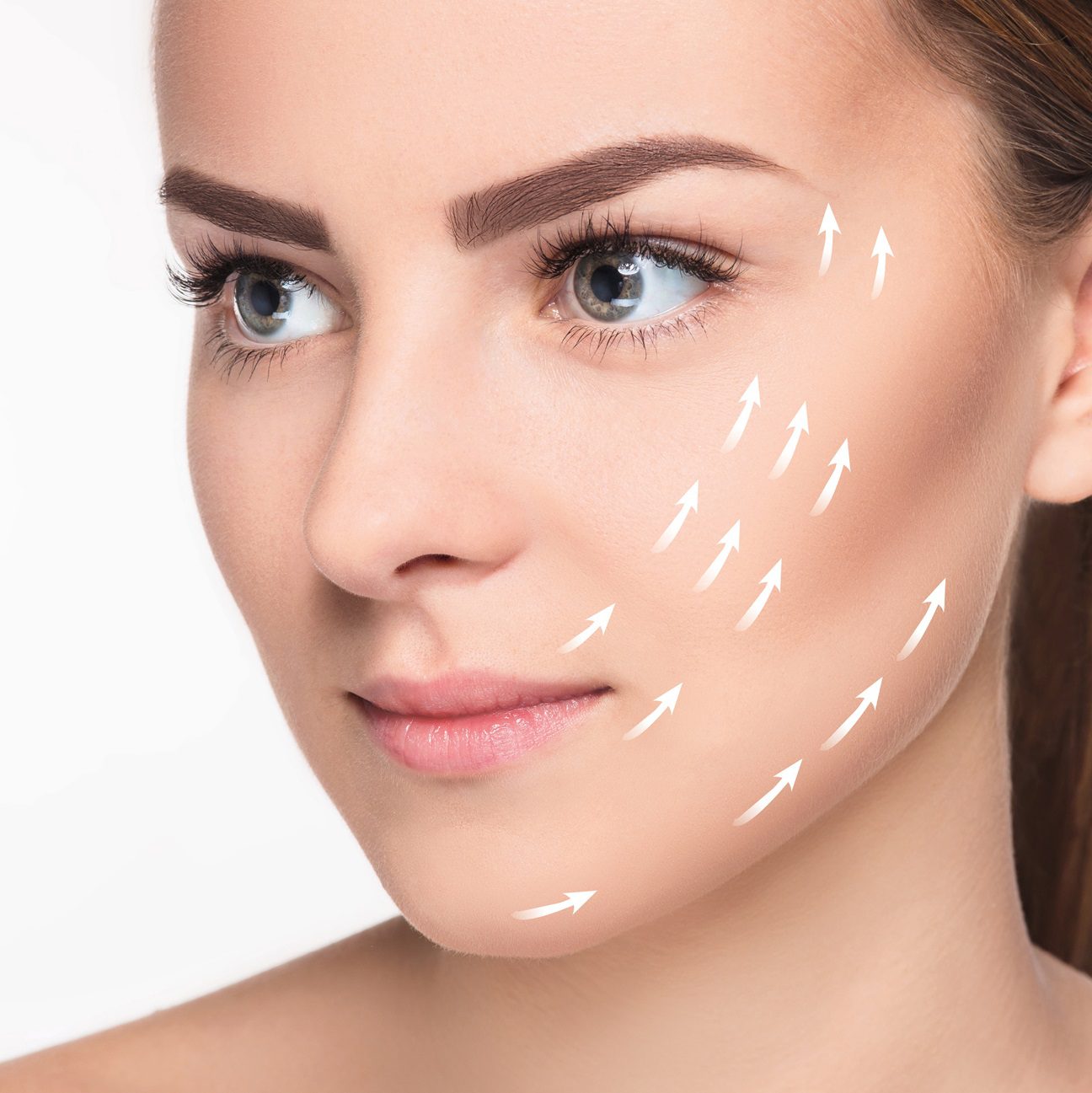 MINT PDO Thread Lift in London, Bournemouth, Lymington