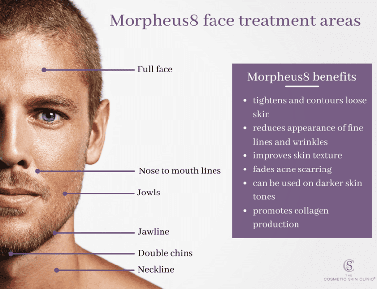Morpheus8 for men | The Cosmetic Skin Clinic