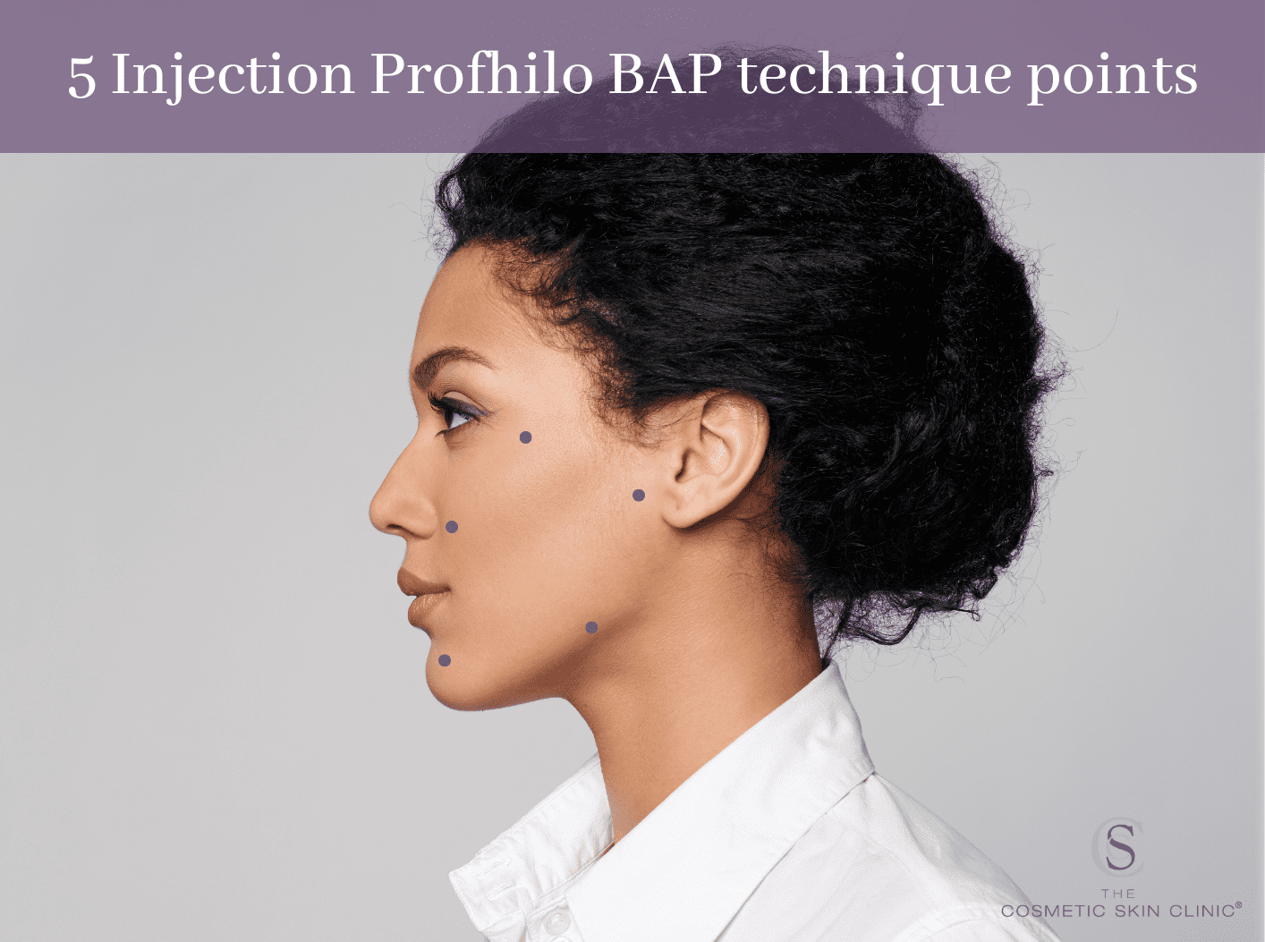 The Profhilo BAP technique – everything you need to know - The Cosmetic Skin Clinic