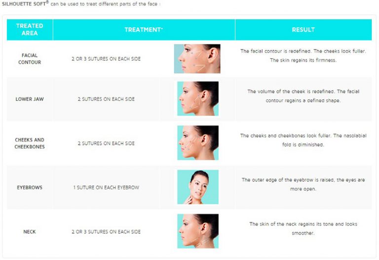 Silhouette Soft Thread Lift for Skin Rejuvenation in London, Bucks ...