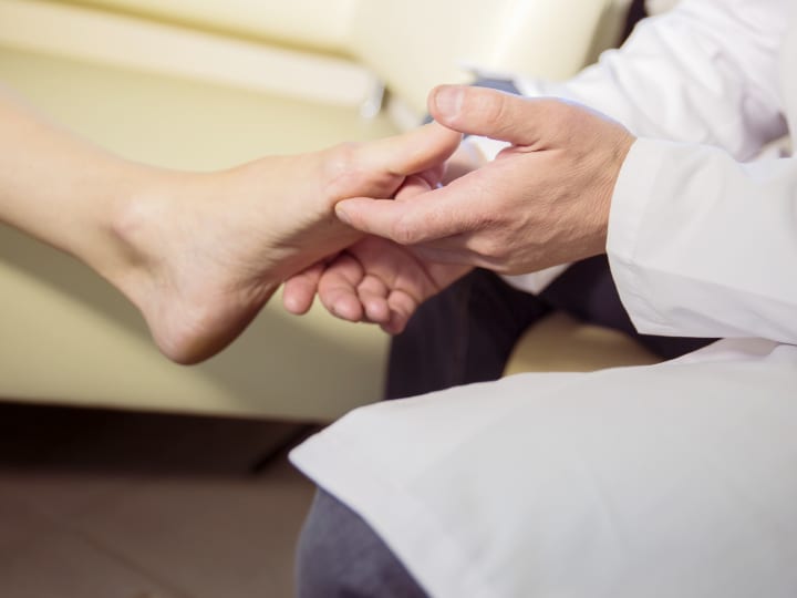 Hammertoe Treatment London | Hammertoe Correction | The Cosmetic Skin ...