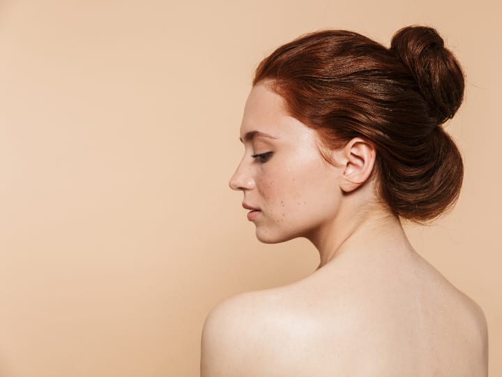 How to Get Rid of Back Fat with CoolSculpting | The Cosmetic Skin Clinic