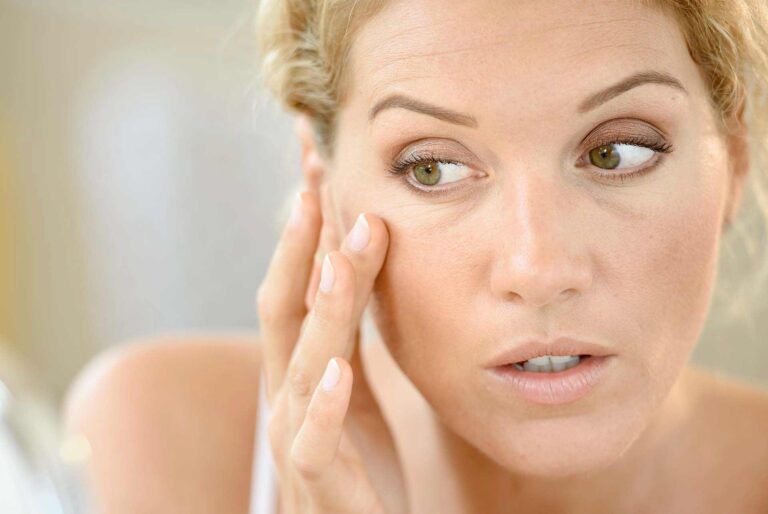 Eye Rejuvenation Case Study | Brighter, Refreshed Eyes - The Cosmetic ...