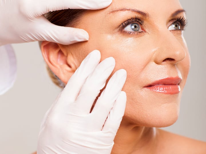 Dermal Fillers 50s Treatment Plan - Full Face Assessment and Results