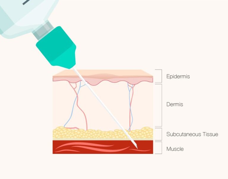 How Botox is injected - Arrival, Consent, Procedure & Aftercare