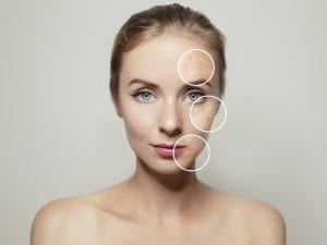 Skin Pigmentation and Age Spots: Causes and Treatments | The Cosmetic ...